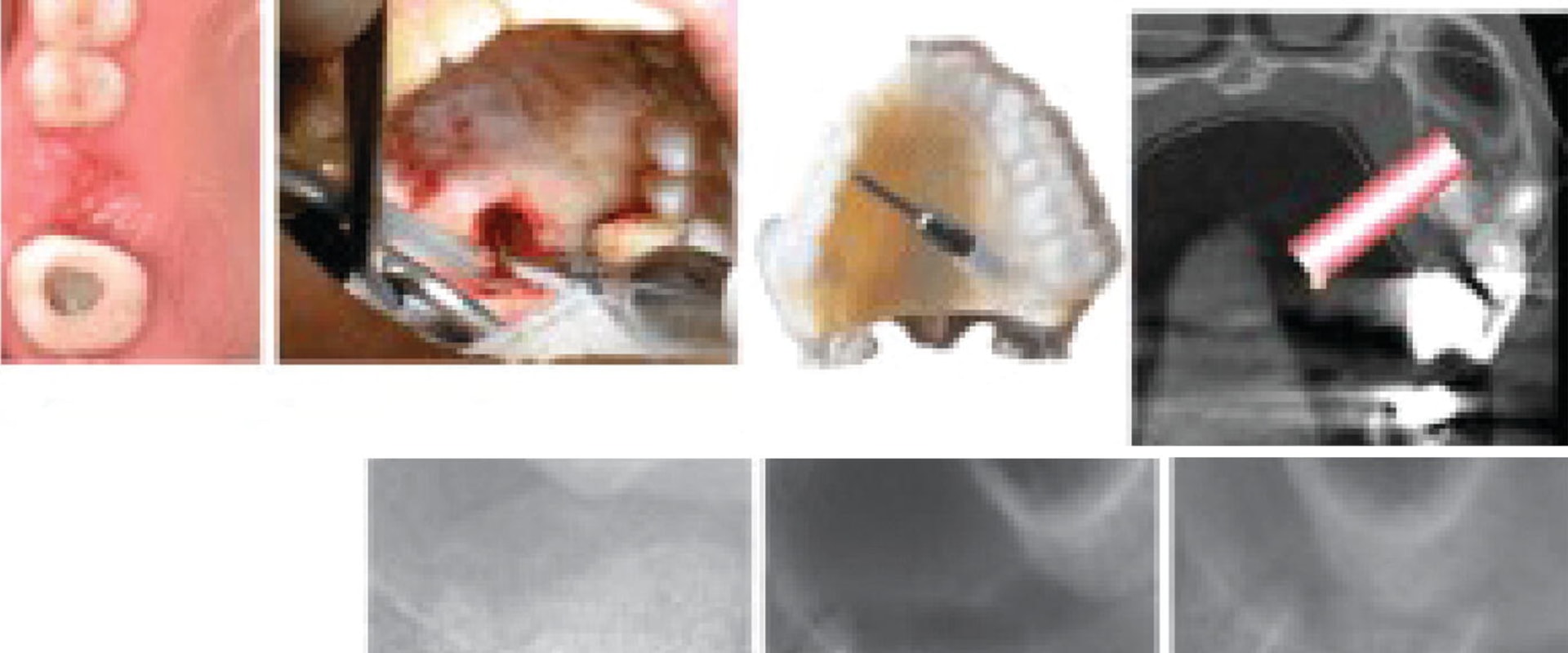 Uncovering the Benefits of Endodontic Explorers for Dentists